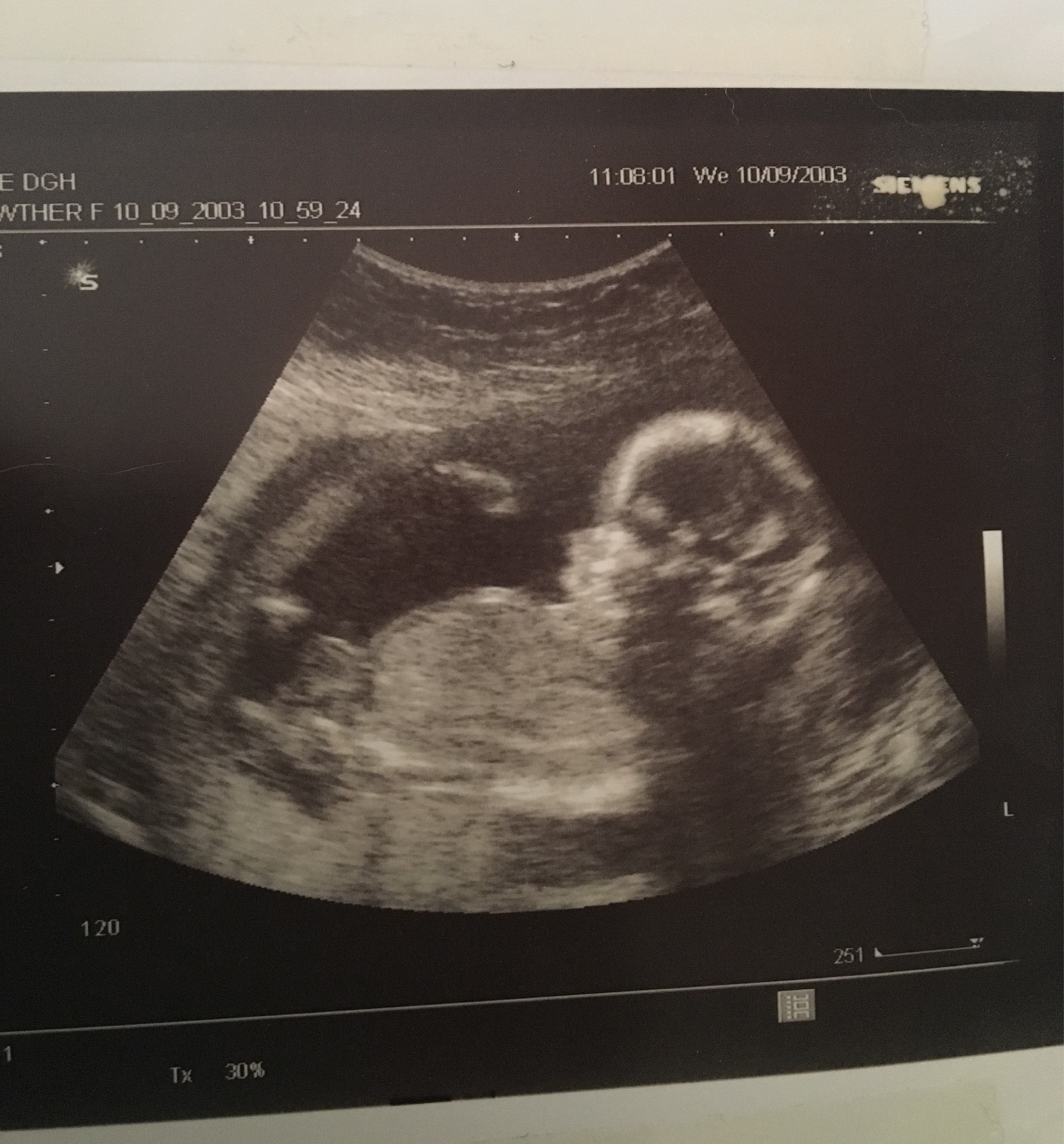 29 Gender Scan 29-gender-scan
